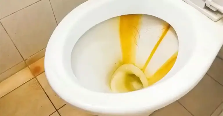 Get Crystallized Urine Out Of Your Toilet Bowl Fast With These DIY Methods!